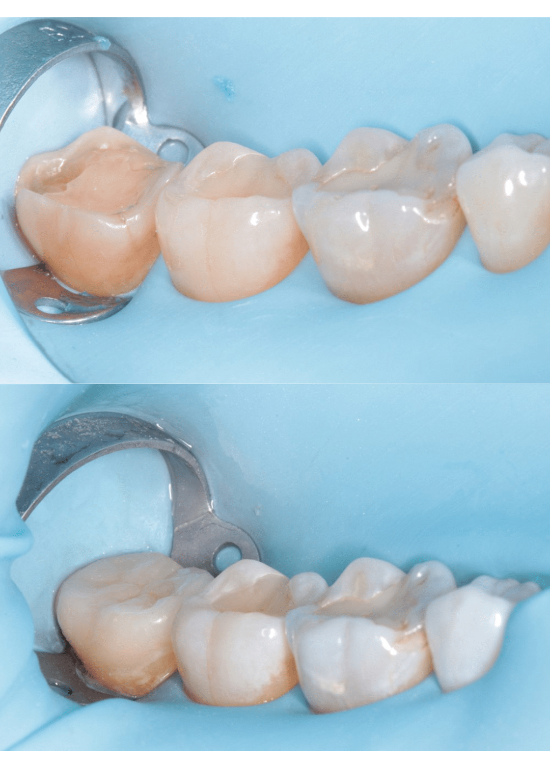 Home - East Peak Dental