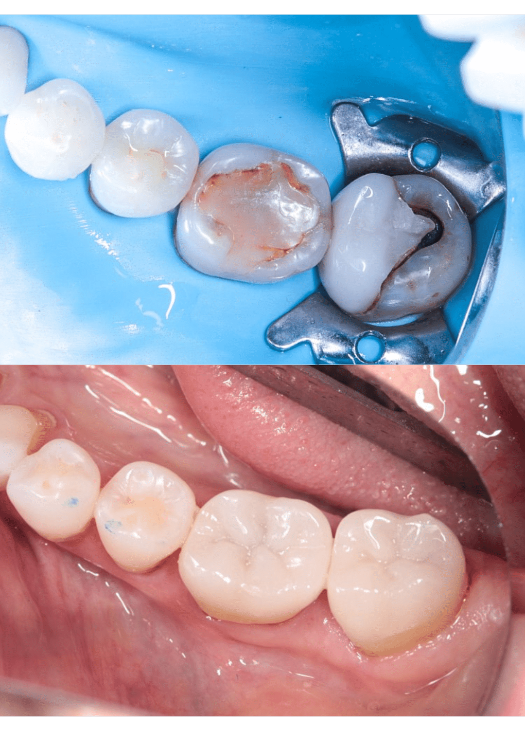 Home - East Peak Dental